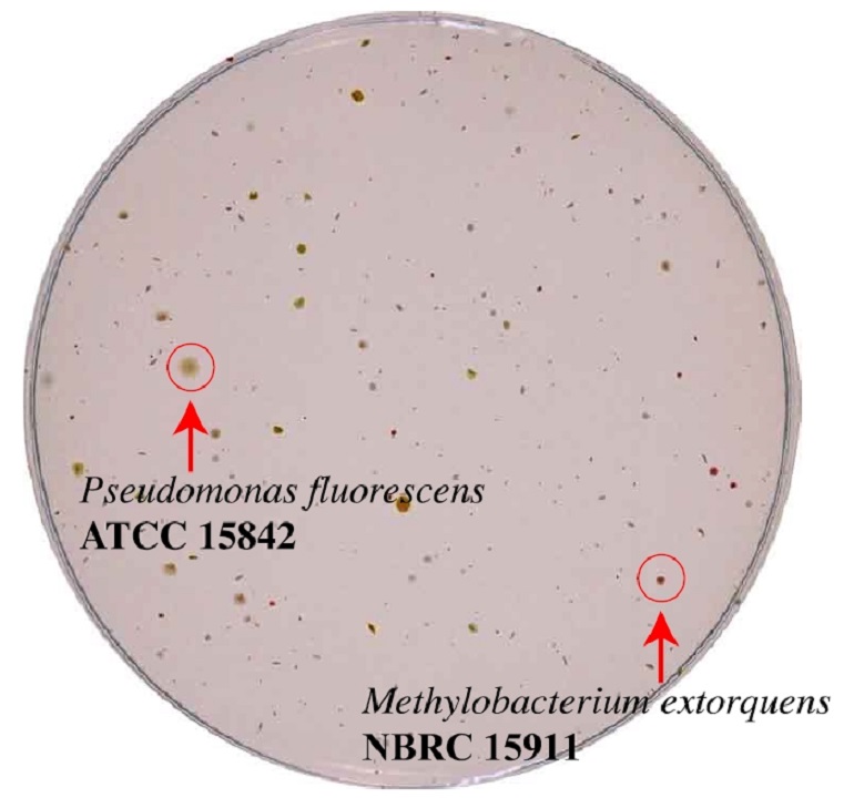 アキュレート™ R2A寒天培地 | 臨床診断薬分野 医療関係者向けサイト | 島津ダイアグノスティクス株式会社