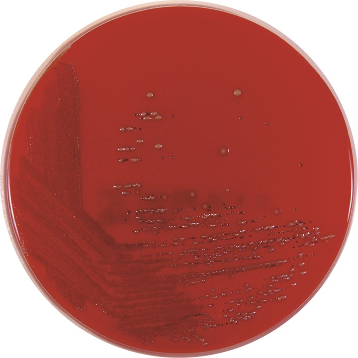 アキュレート™ ABHK寒天培地 | 臨床診断薬分野 医療関係者向けサイト | 島津ダイアグノスティクス株式会社