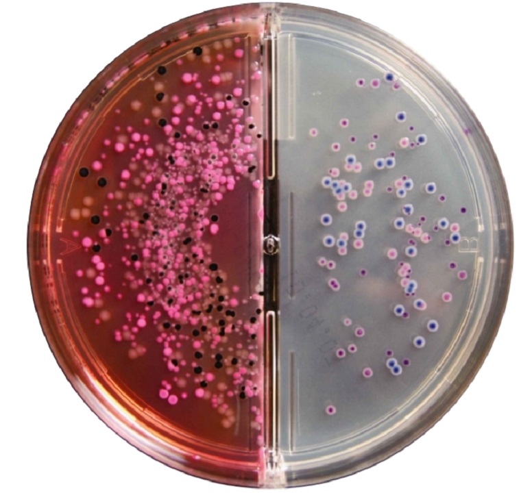 アキュレート™ 分画 Sタイプ／XM-EHEC | 臨床診断薬分野 医療関係者向けサイト | 島津ダイアグノスティクス株式会社