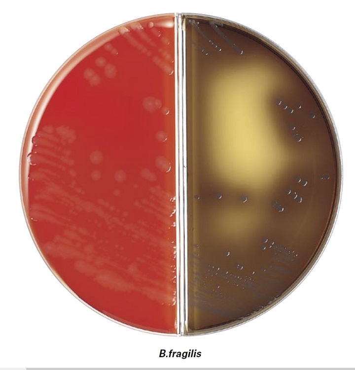 アキュレート™ 分画 ABHK寒天／BBE寒天 | 臨床診断薬分野 医療関係者向けサイト | 島津ダイアグノスティクス株式会社