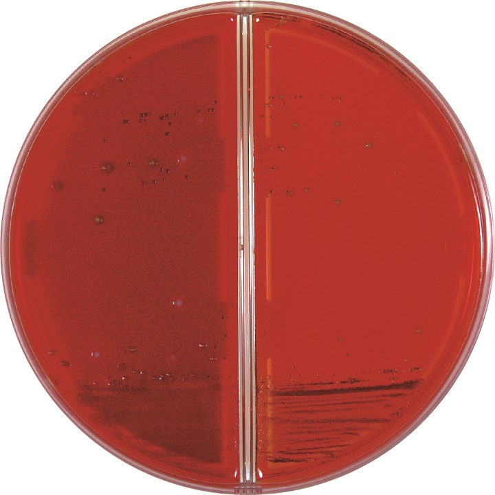 アキュレート™ 分画 ABHK寒天／NV加ABHK寒天 | 臨床診断薬分野 医療関係者向けサイト | 島津ダイアグノスティクス株式会社