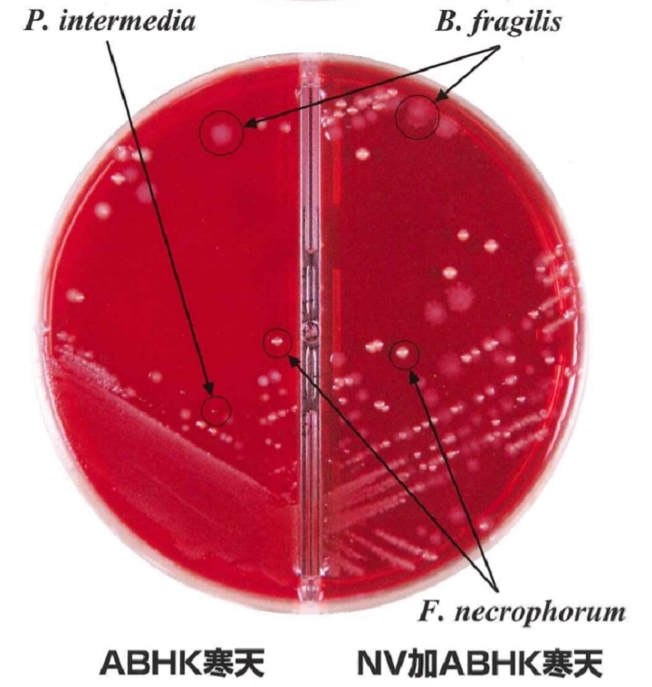 アキュレート™ 分画 ABHK寒天／NV加ABHK寒天 | 臨床診断薬分野 医療関係者向けサイト | 島津ダイアグノスティクス株式会社
