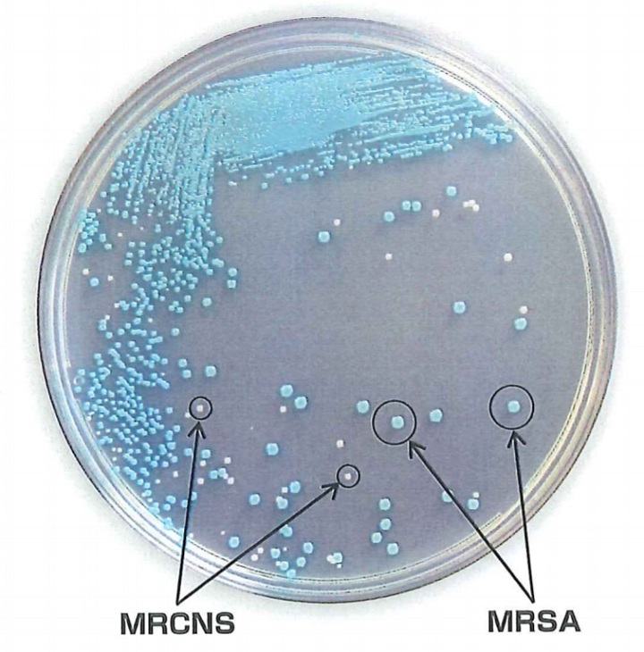 アキュレート™ X-MRSA寒天培地 | 臨床診断薬分野 医療関係者向けサイト | 島津ダイアグノスティクス株式会社